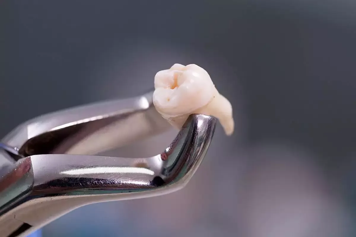 Bank House | Tooth Extractions in Chester | Modern Dental Technology